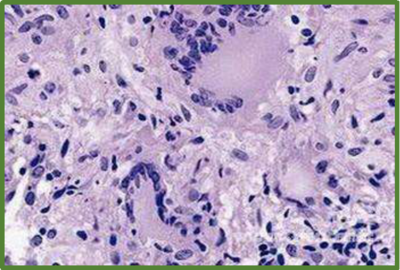 ICG00203 Corynebacterium pseudotuberculosis - Internal Control Genes ...