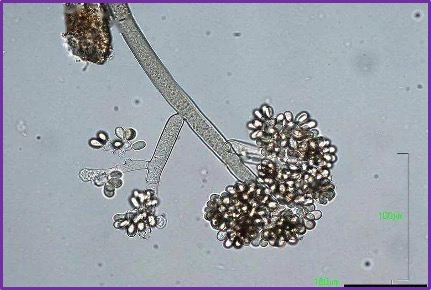 ICG10081 Botrytis cinerea - Internal Control Genes Database (ICG)