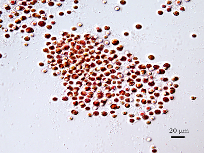 Home - Protist 10,000 Genomes Project (P10K)